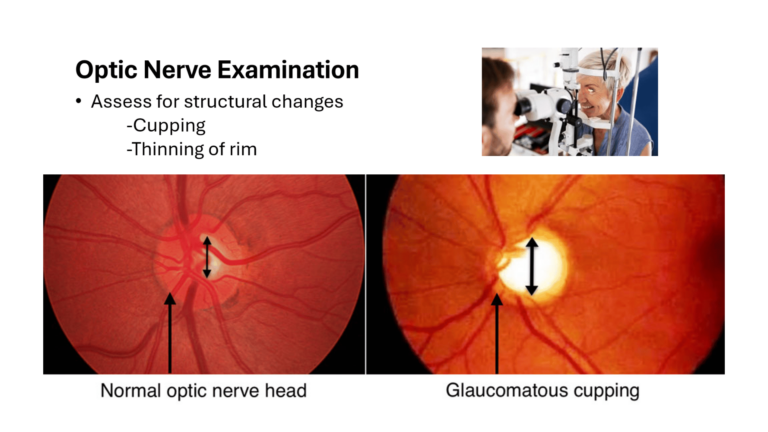 Julia Walker: Demystifying Glaucoma Testing | Glaucoma NZ